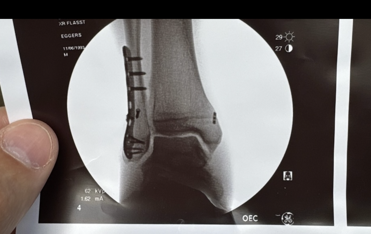 Dj Brandt Down, but Not Out After A Hard Crash in Utah